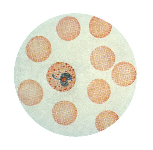 Details - Public Health Image Library(PHIL)