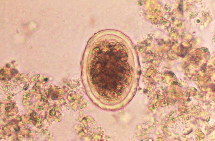 Details - Public Health Image Library(PHIL)