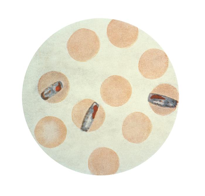 Details - Public Health Image Library(PHIL)