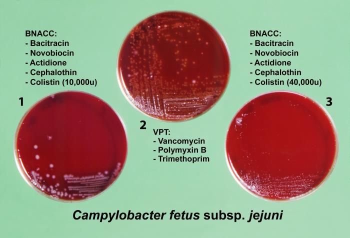 Details - Public Health Image Library(PHIL)