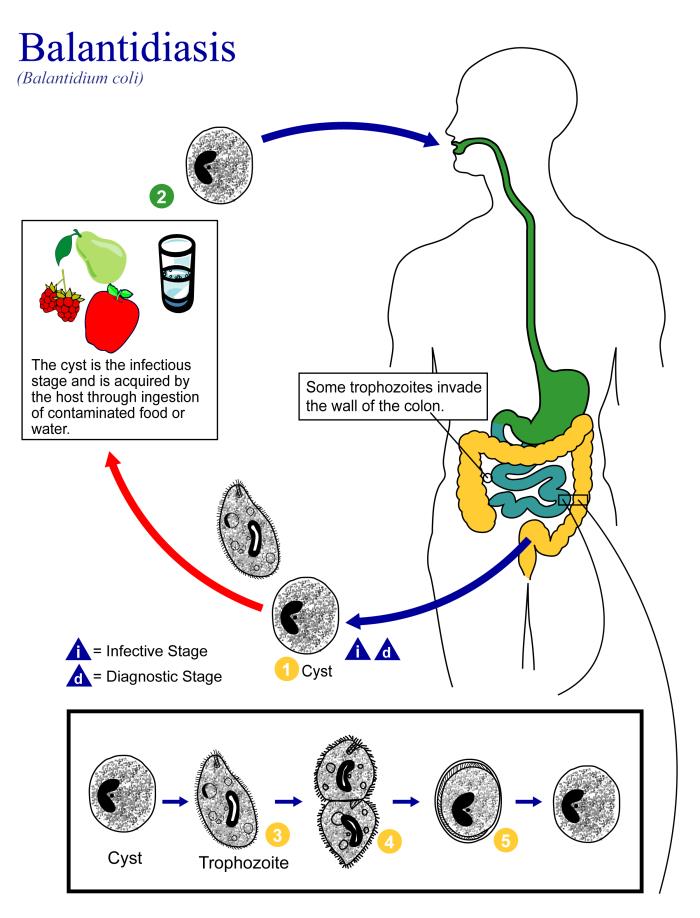 Details - Public Health Image Library(PHIL)